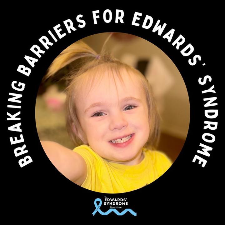 🦄 @fionamosaictrisomy18 - Fiona